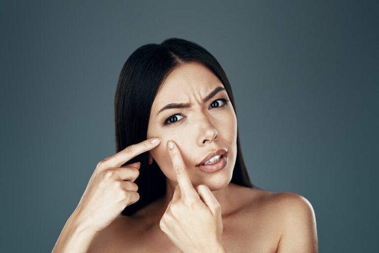 Qui peut avoir à utiliser des soins du visage pour l'acné