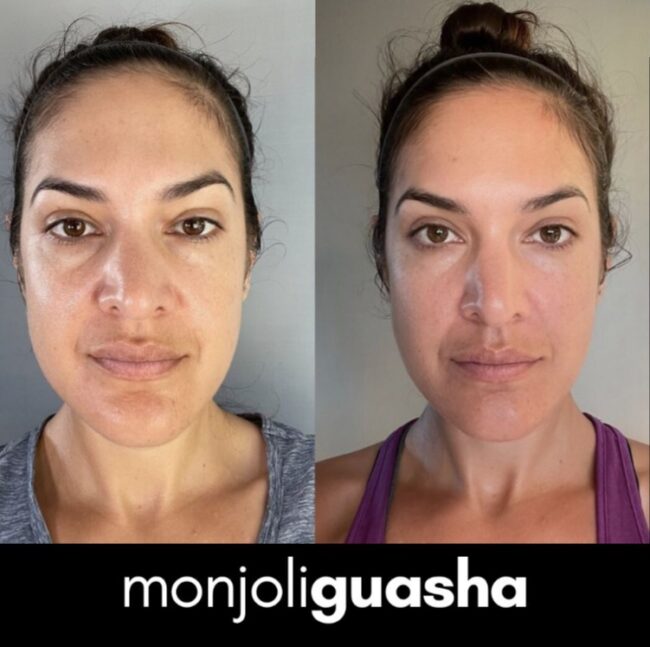 Gua Sha Visage : Utilisations, Bienfaits et Avant/Après